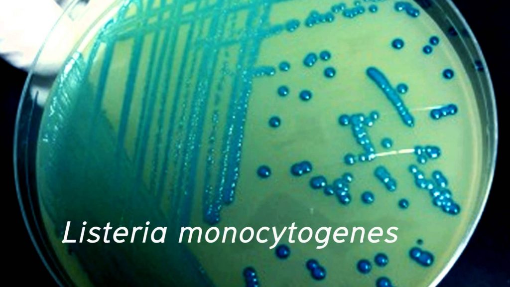 Labosabrinnel | Listeria monocytogene - Labosabrinnel